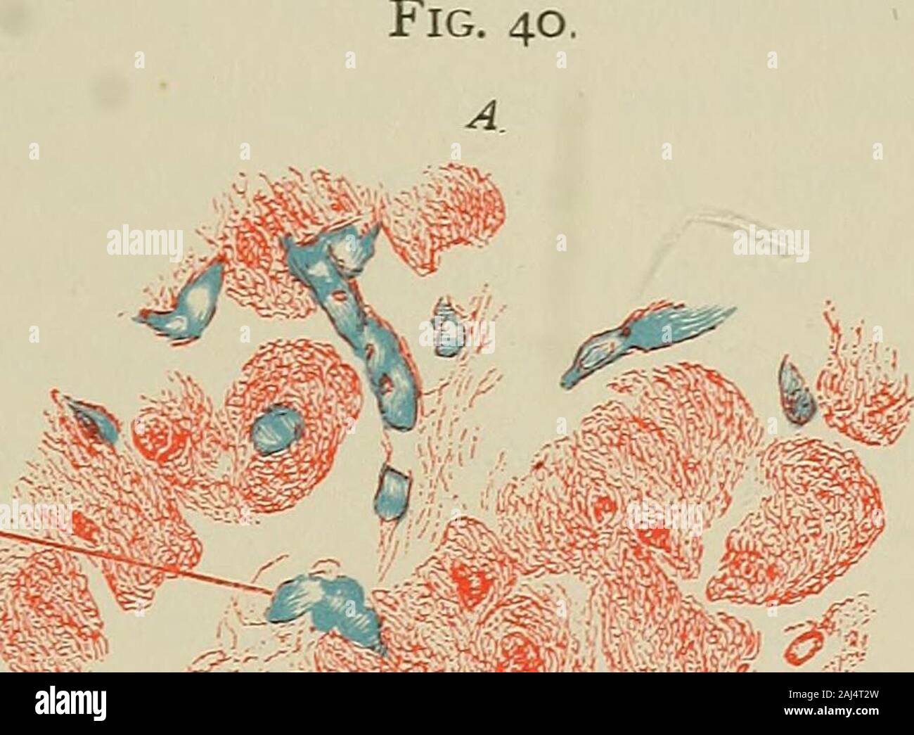 Lead encephalopathy hi-res stock photography and images - Alamy