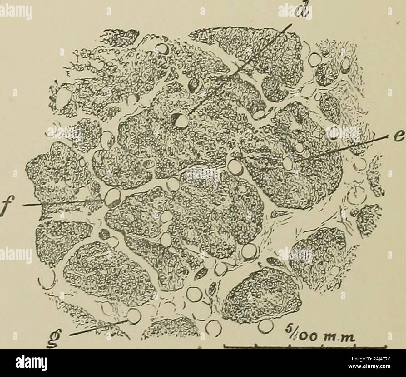 Lead encephalopathy hi-res stock photography and images - Alamy