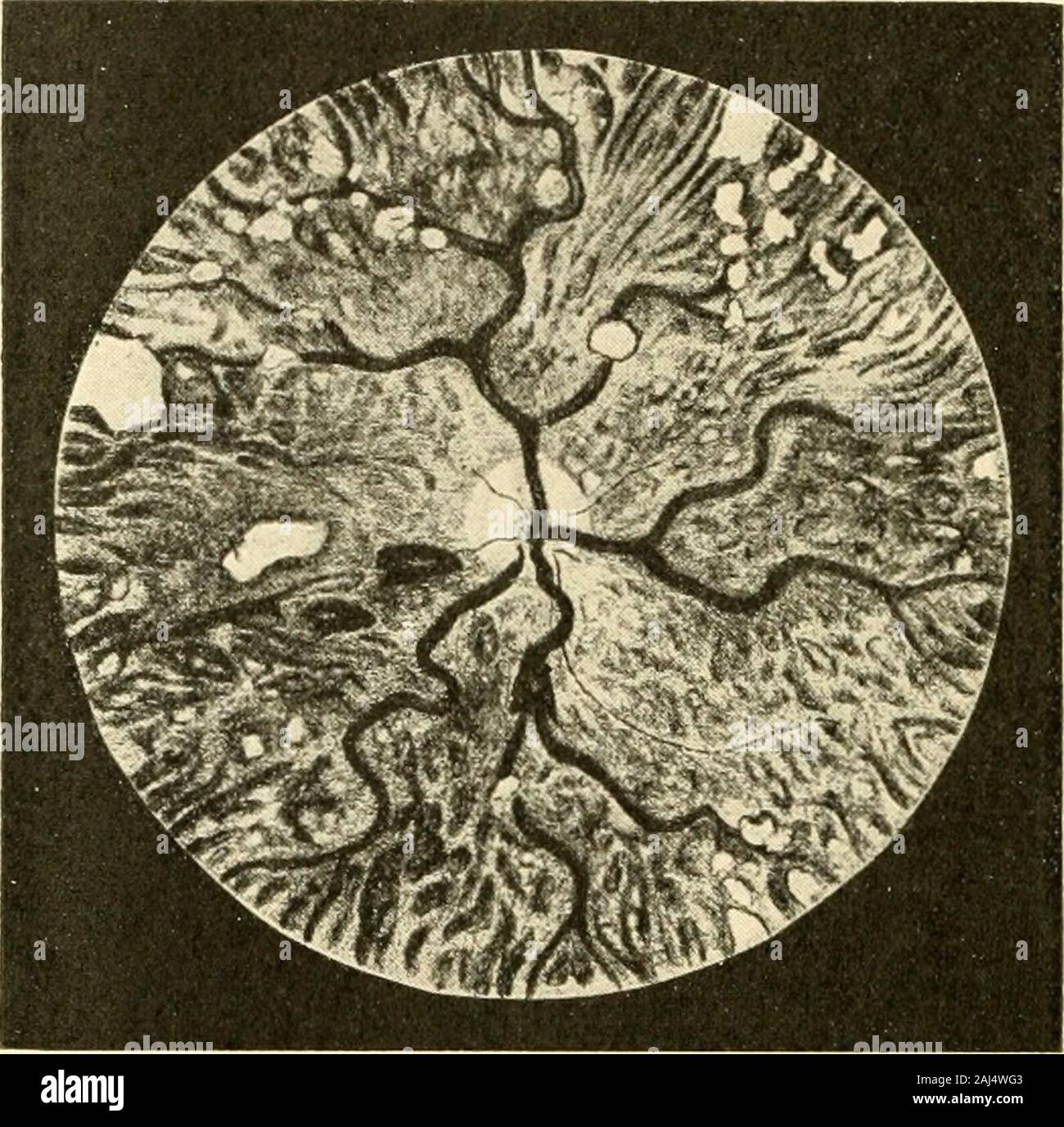 Katarakte hi-res stock photography and images - Alamy