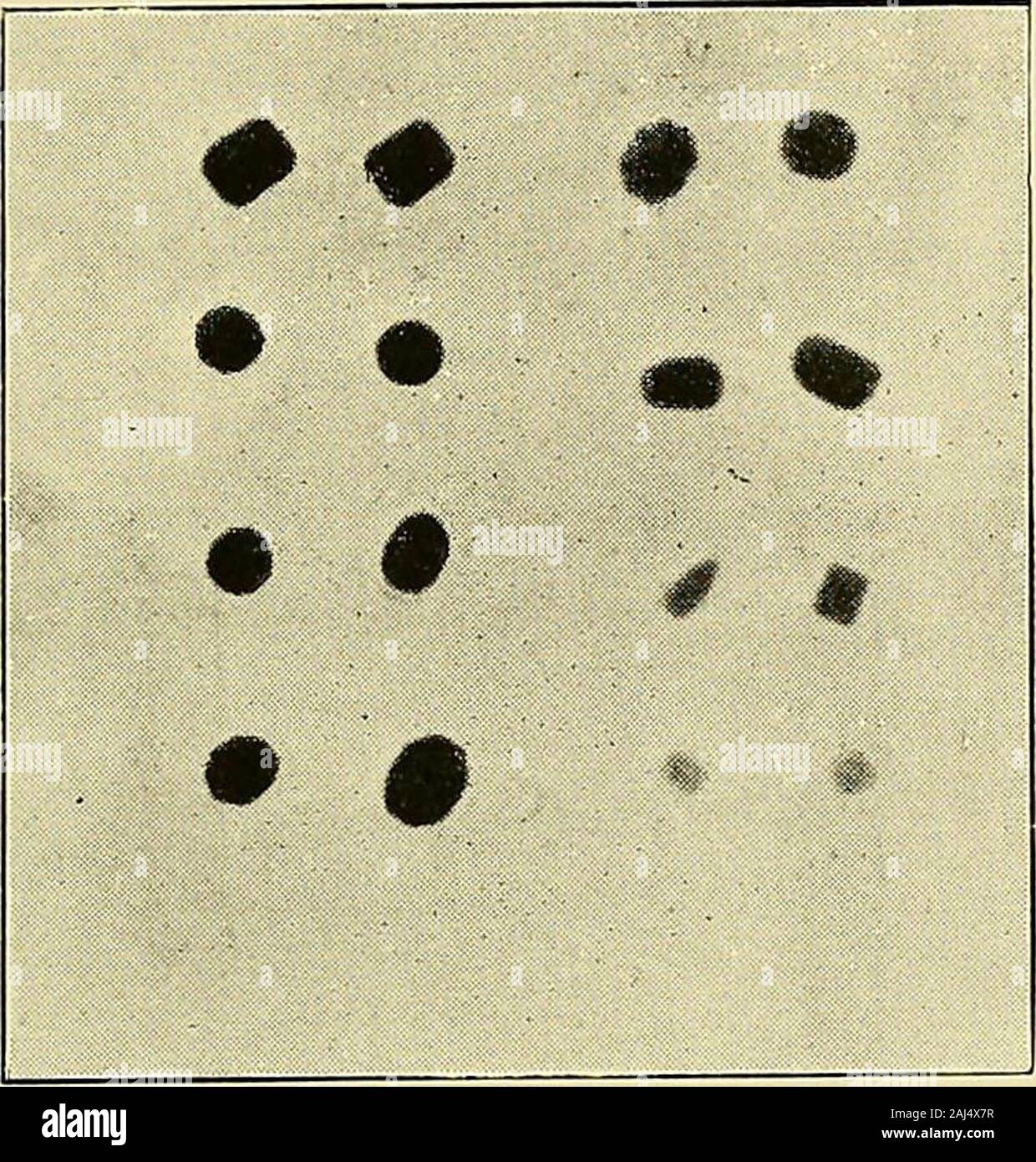 Finsen light hi-res stock photography and images - Alamy