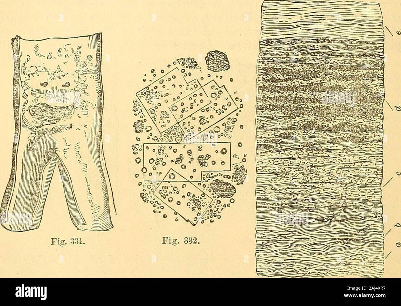 Brittle substance hi-res stock photography and images - Alamy