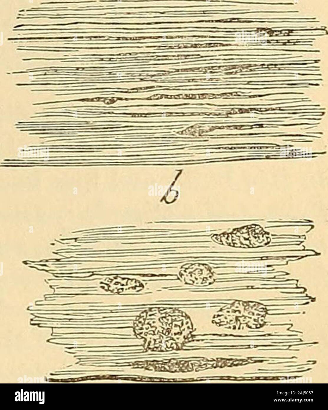 Clinical lectures on the principles and practice of medicine . Fig. 311 ...