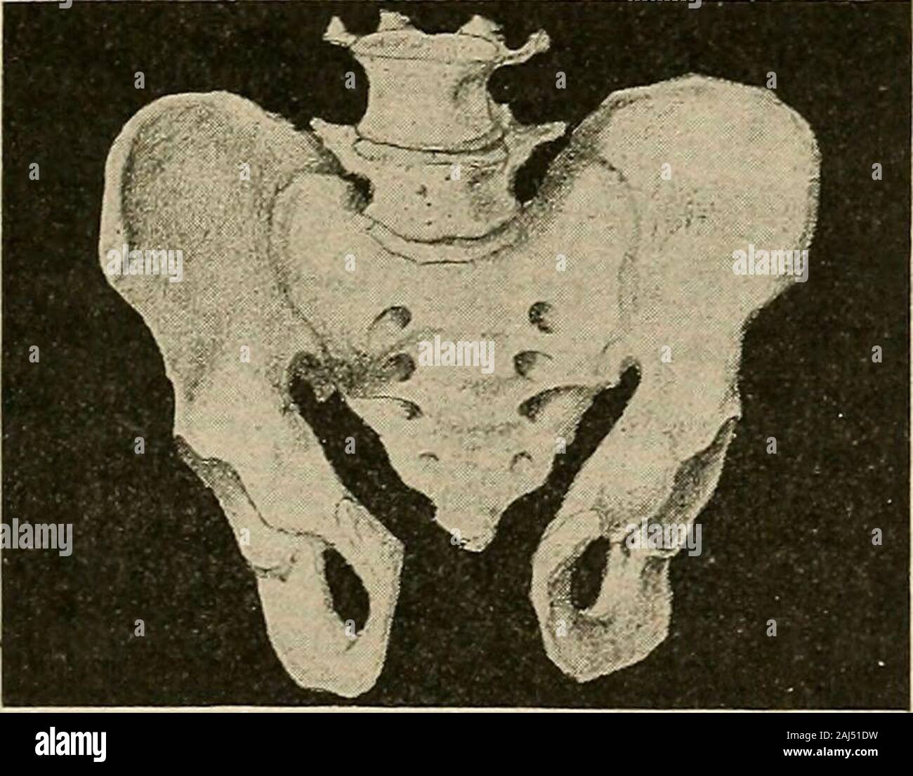Over exerted hi-res stock photography and images - Alamy