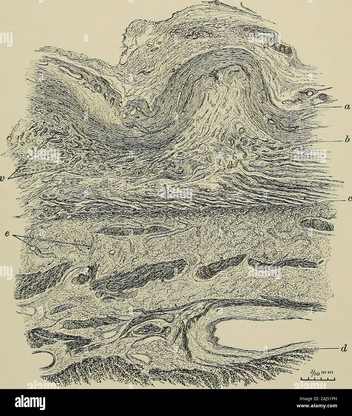 The origin of disease : especially of disease resulting from intrinsic ...