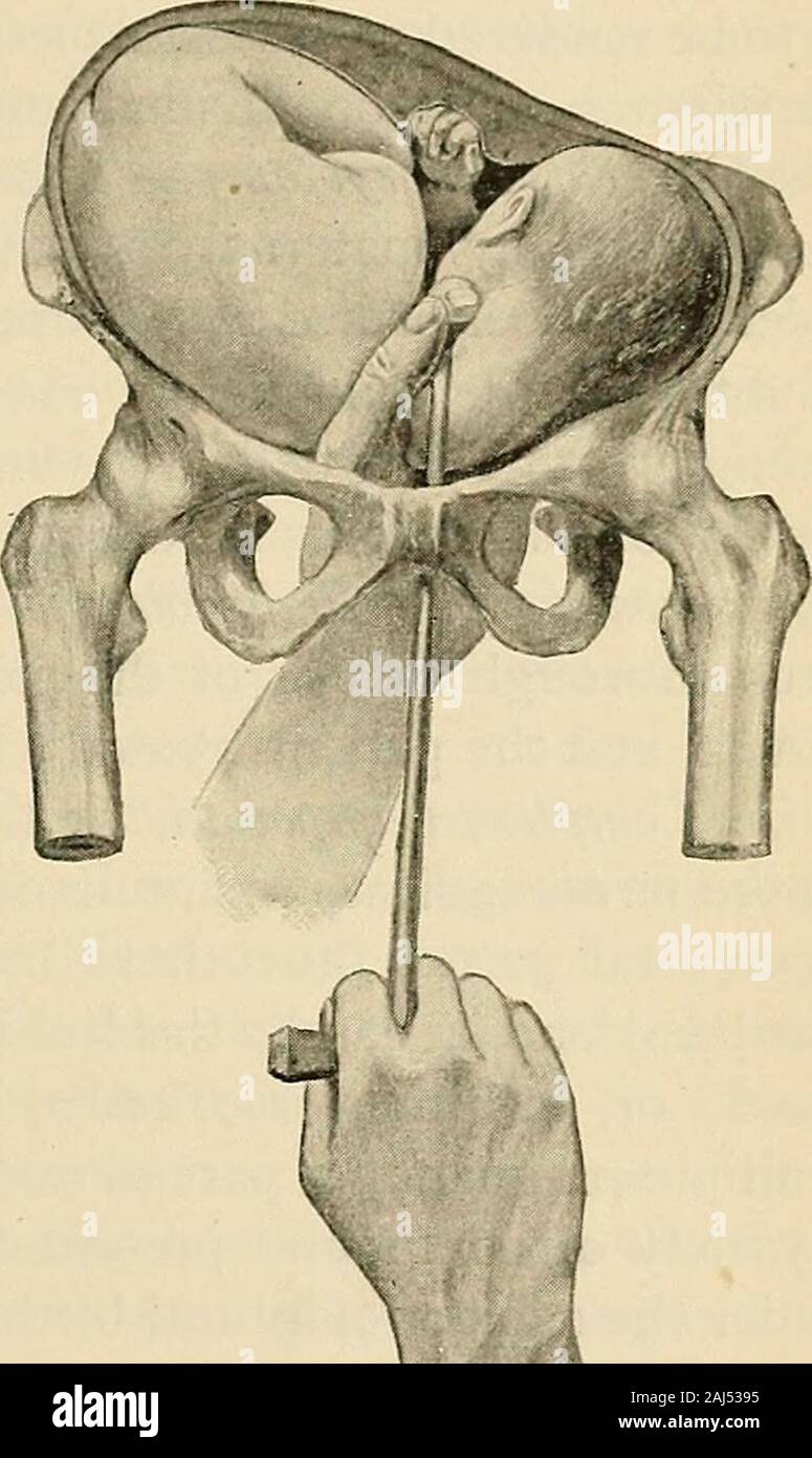 134 steps hi-res stock photography and images - Alamy