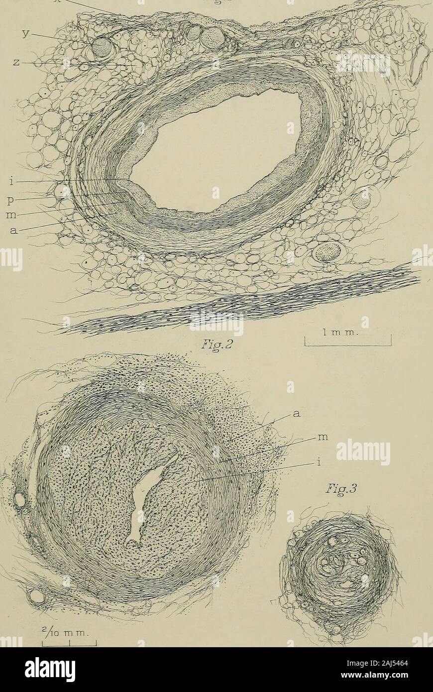 The origin of disease : especially of disease resulting from intrinsic ...