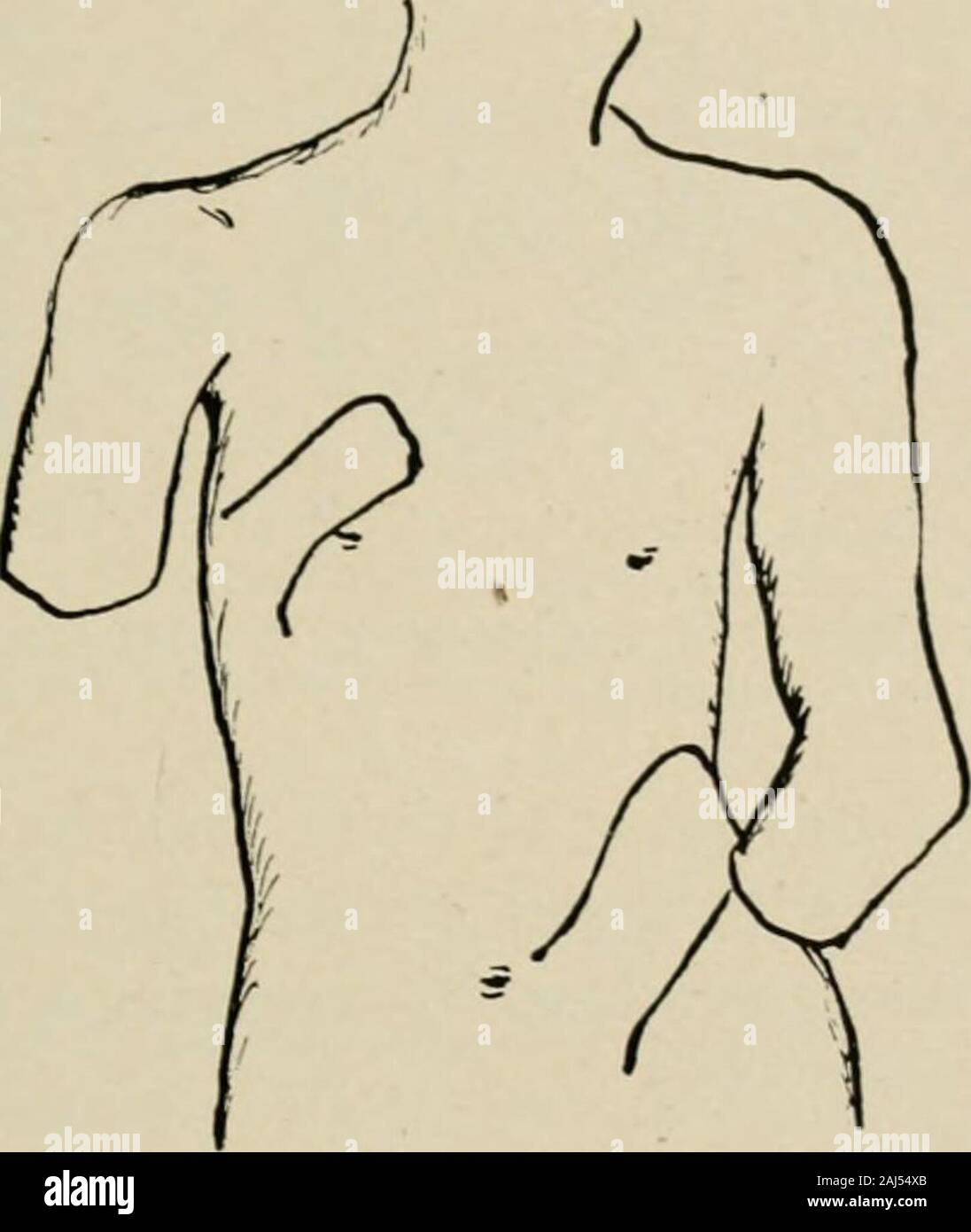 Skin traction hi-res stock photography and images - Alamy