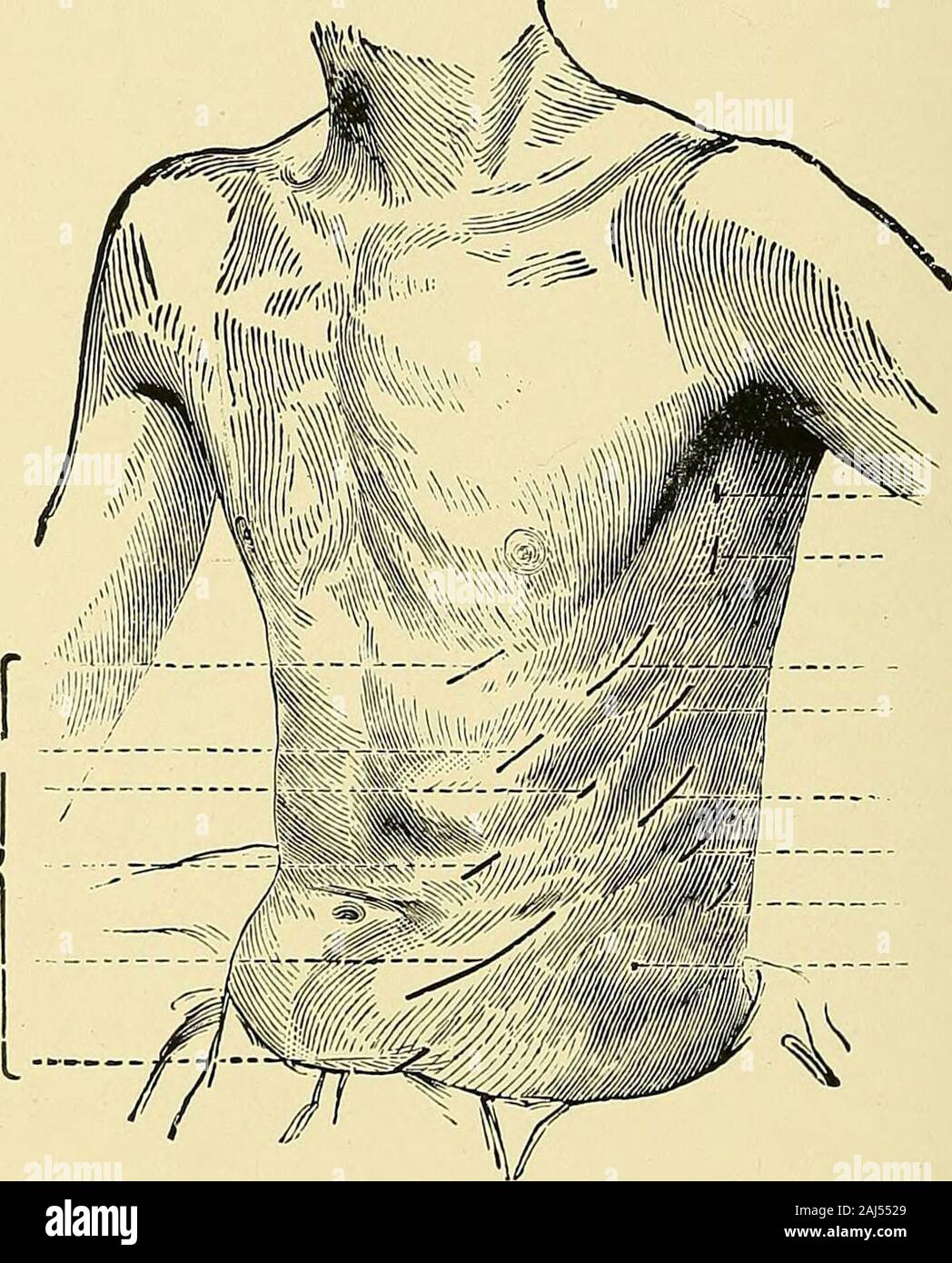 Motor nerves leg muscles hi-res stock photography and images - Alamy