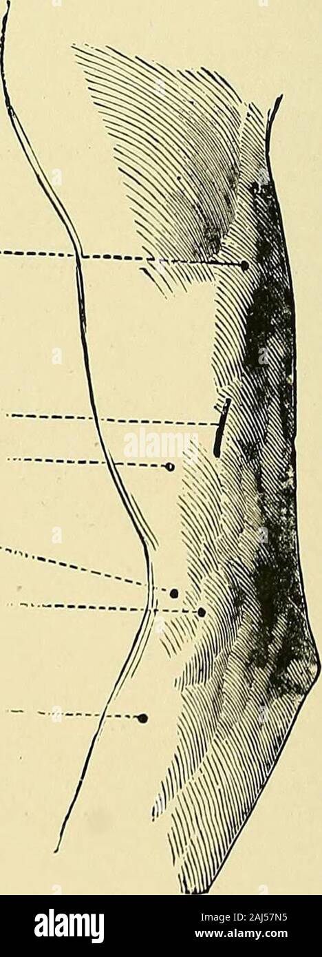Posterior cutaneous nerve of arm hi-res stock photography and images ...
