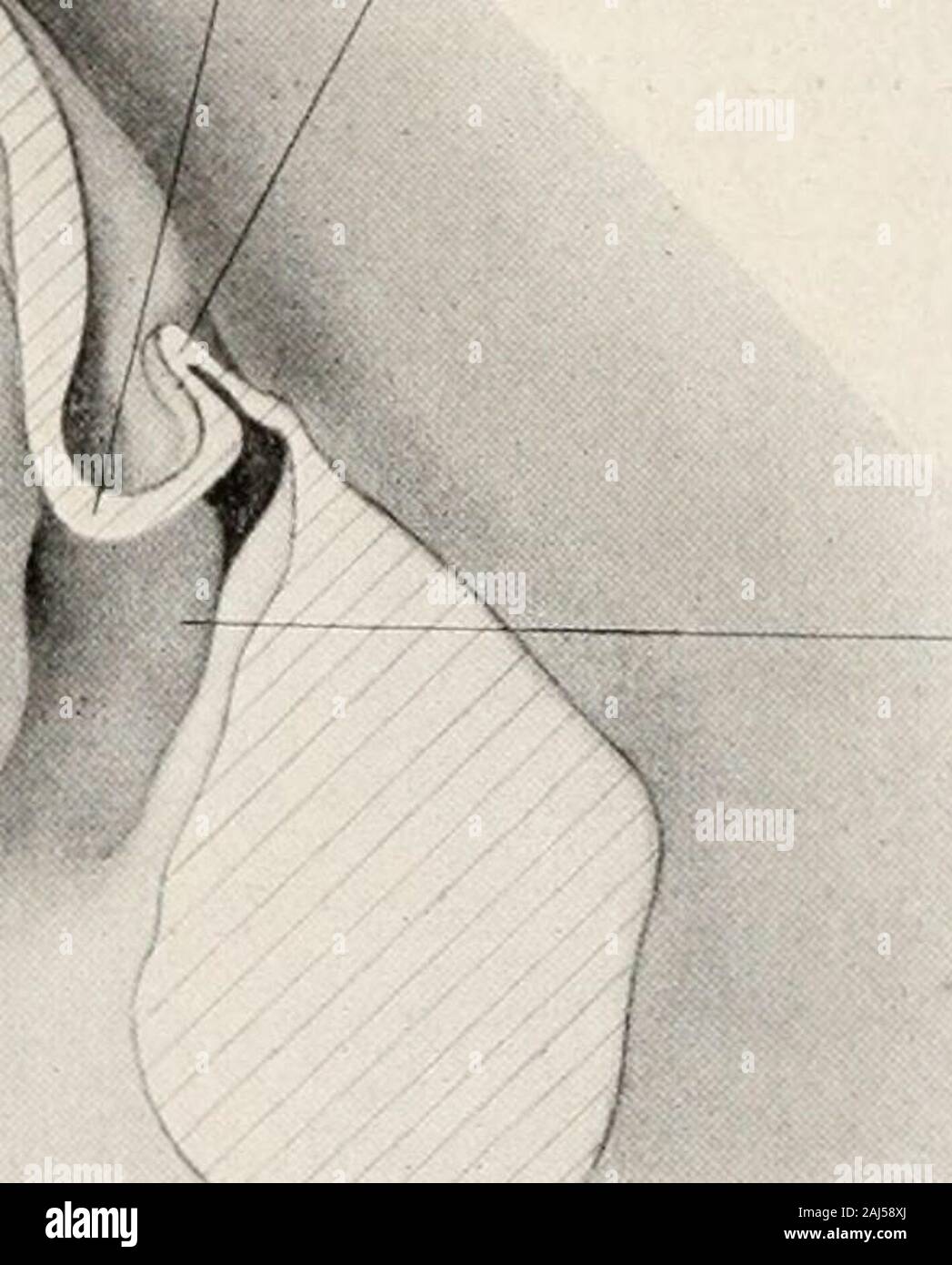 The morphology and evolutional significance of the pineal body : being ...