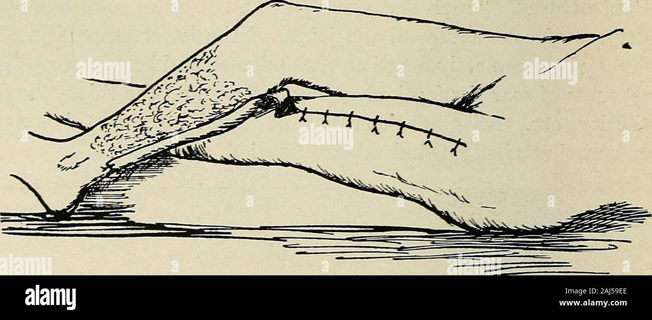 Plastic surgery; its principles and practice . Fig. 823.—Extensive ...