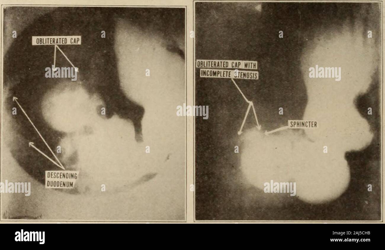 Interstate medical journal . he original plates in thelight of added ...