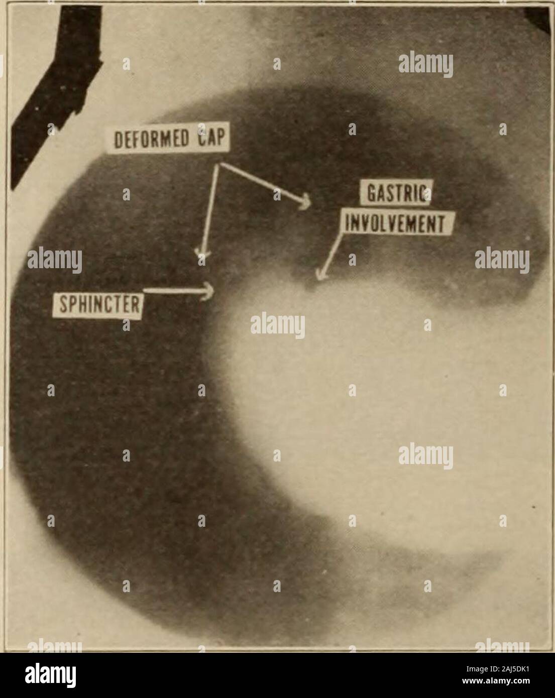 Interstate medical journal . eight loss of 7 or 8pounds recently. 34 ...