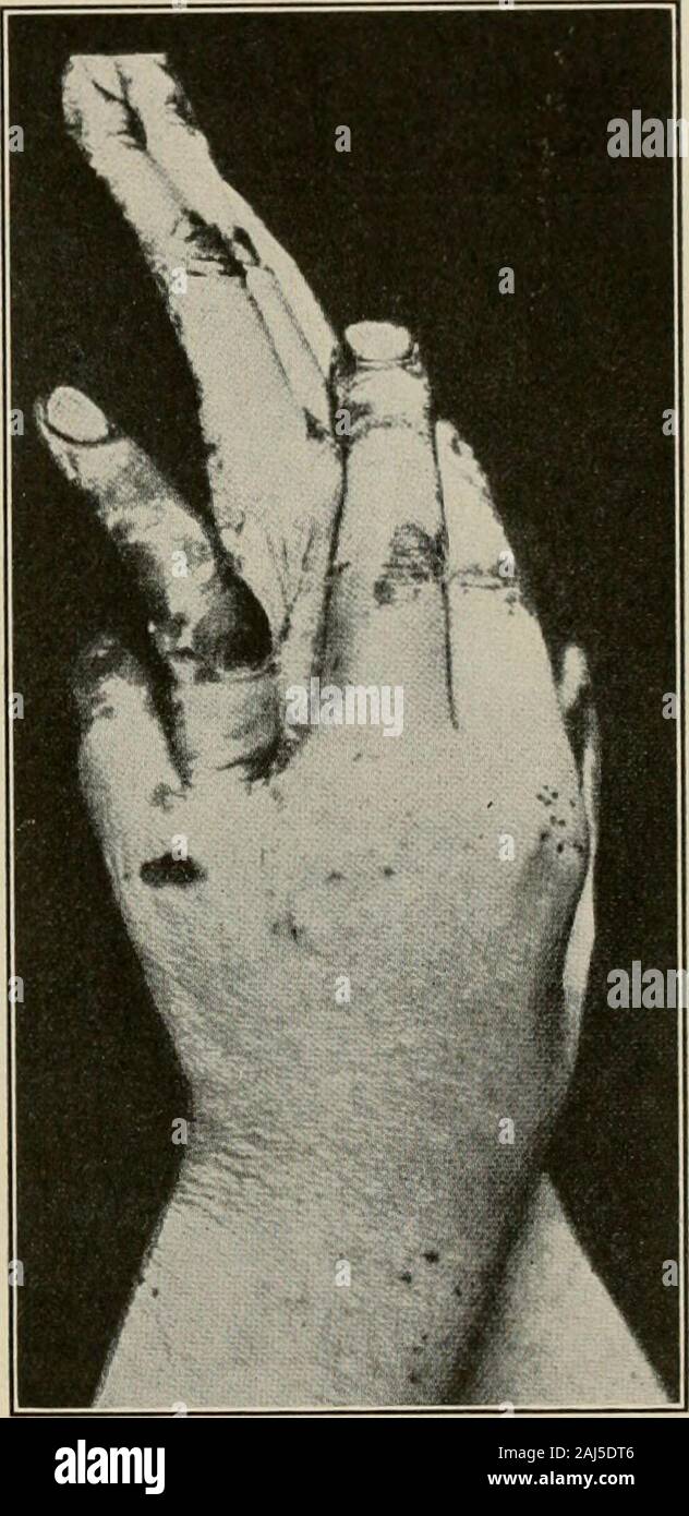 Plastic surgery; its principles and practice . Fig. 80s. Fig. 806. The ...