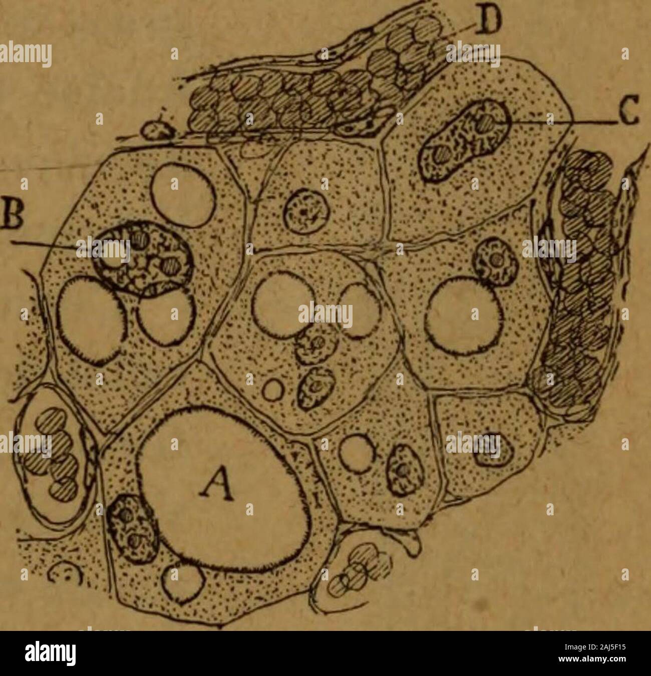 Glándulas sebáceas hi-res stock photography and images - Alamy