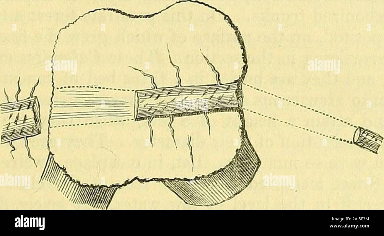 Dawson formation hi-res stock photography and images - Alamy