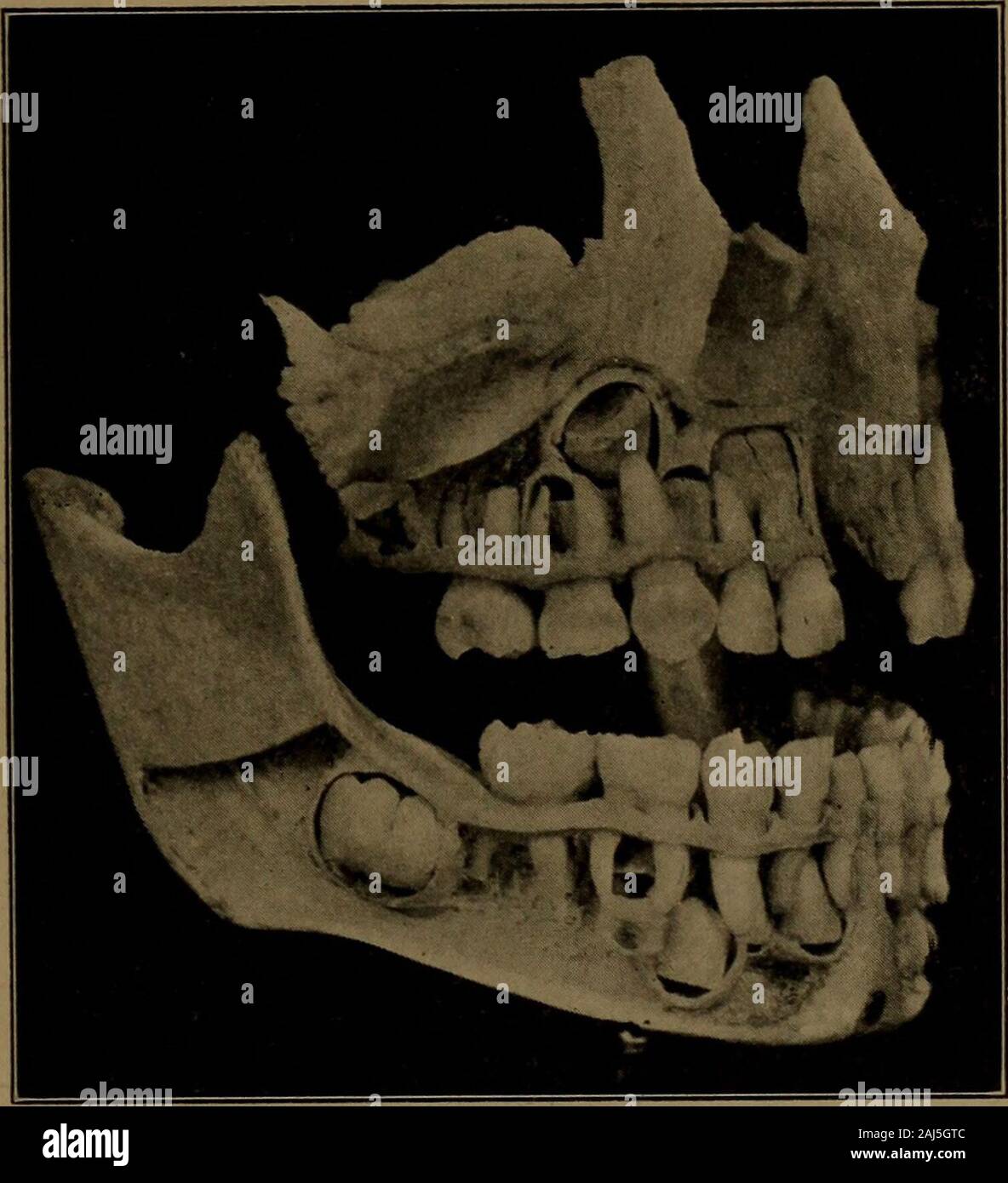 A text-book of dental histology and embryology, including laboratory ...