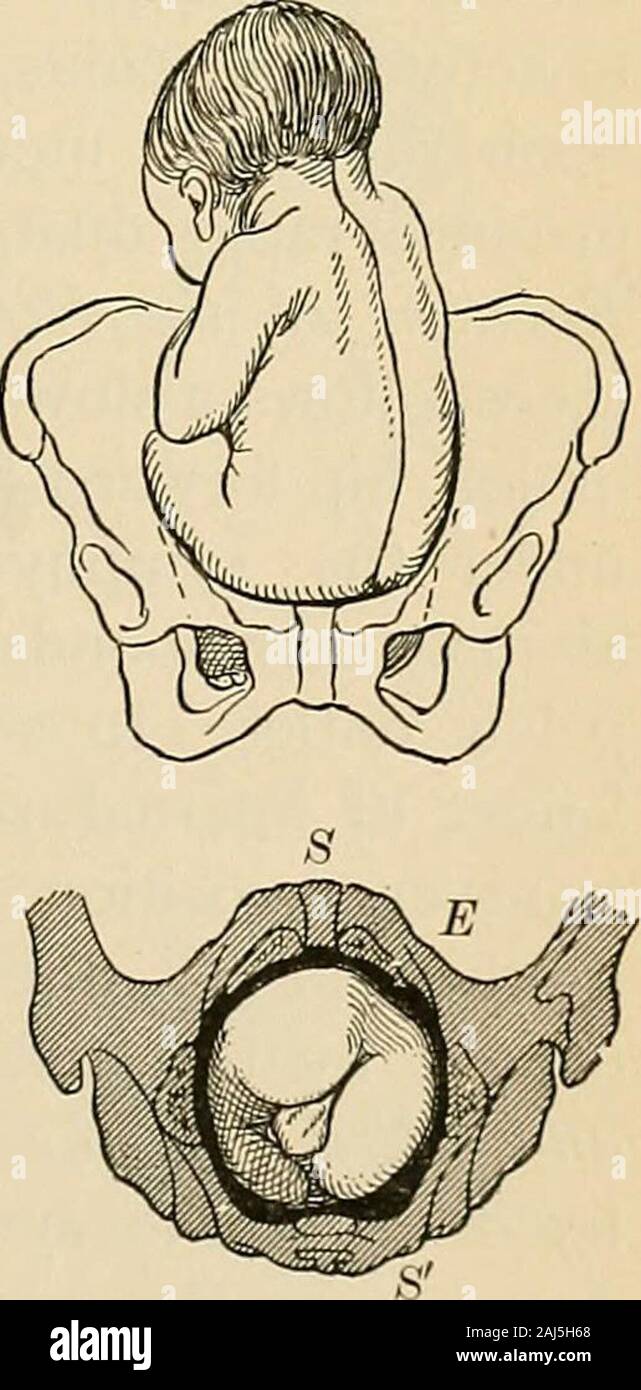 A manual of obstetrics . ght tibioanterior ; symbol, R. T. A ; (3) the ...
