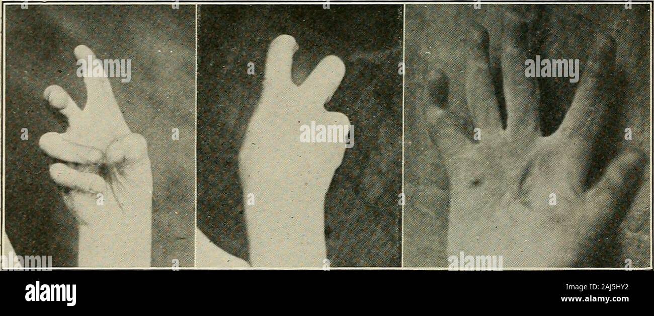 Plastic surgery; its principles and practice . Pig. 785. Fig. 786. Fig ...