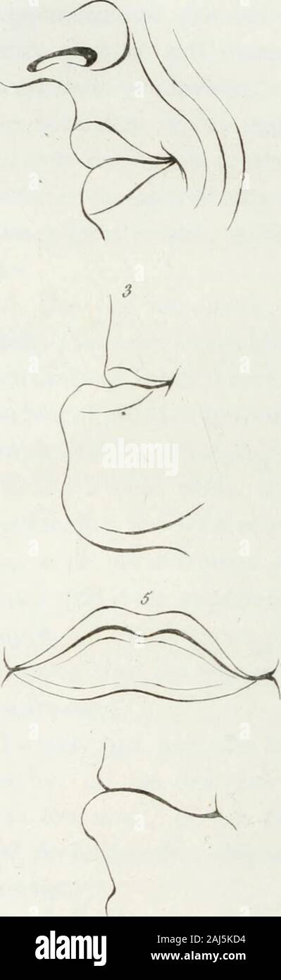 Nez retroussé hi-res stock photography and images - Alamy