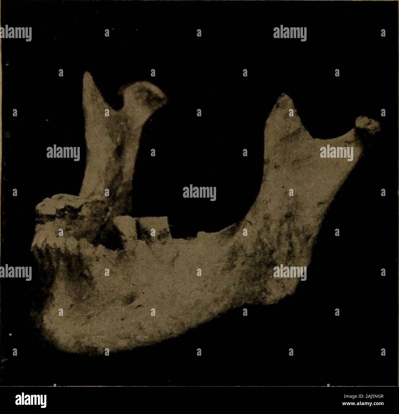 A text-book of dental histology and embryology, including laboratory ...