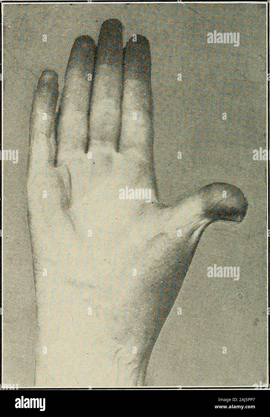 Plastic surgery; its principles and practice . FiG. 778. Fig. 779. Fig ...