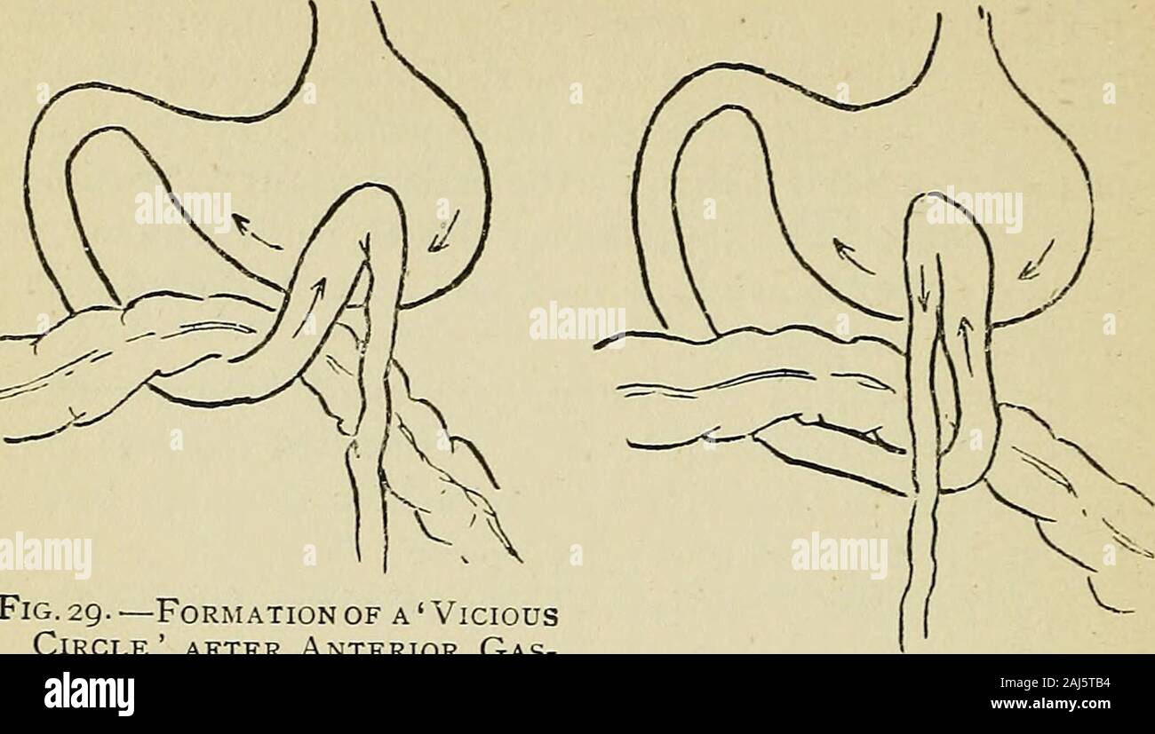 Proximal Vs Distal Stomach