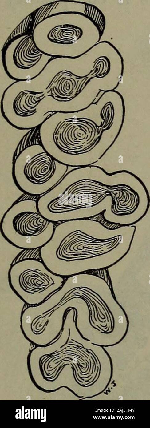 Bullae skin hi-res stock photography and images - Alamy