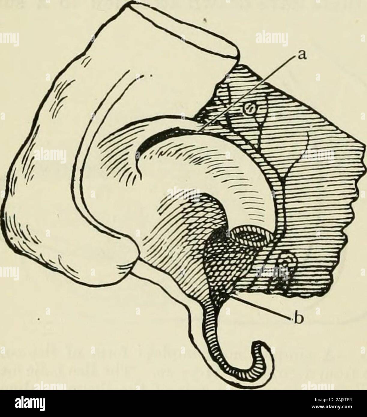 Some points in the anatomy, pathology, and surgery of intussusception ...