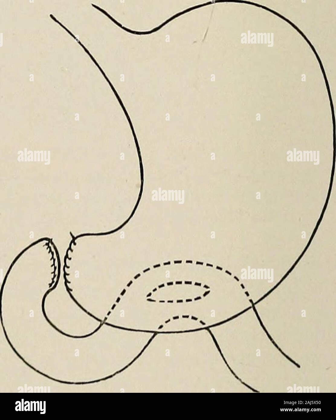 Surgical treatment; a practical treatise on the therapy of surgical ...