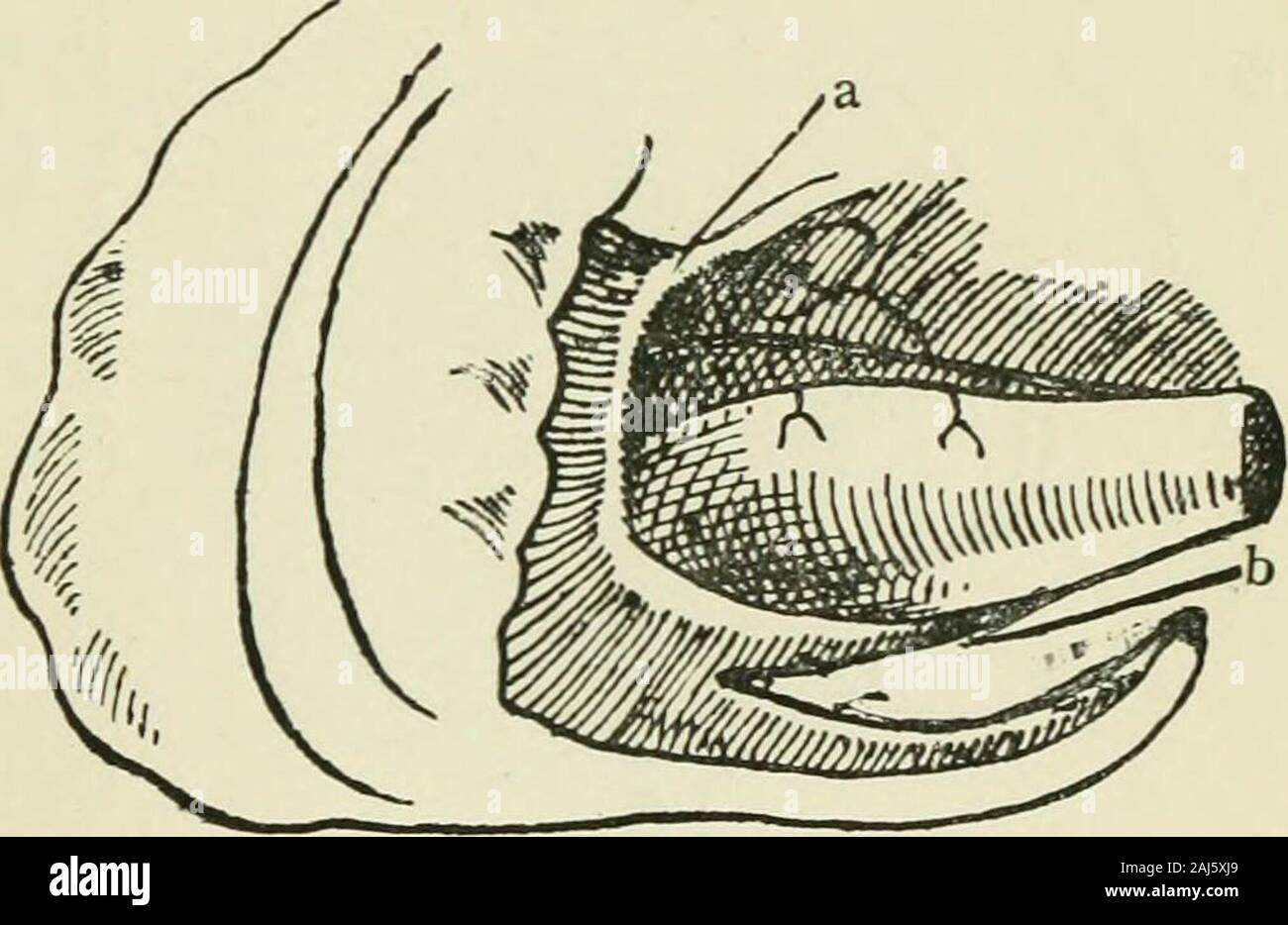 Some points in the anatomy, pathology, and surgery of intussusception ...