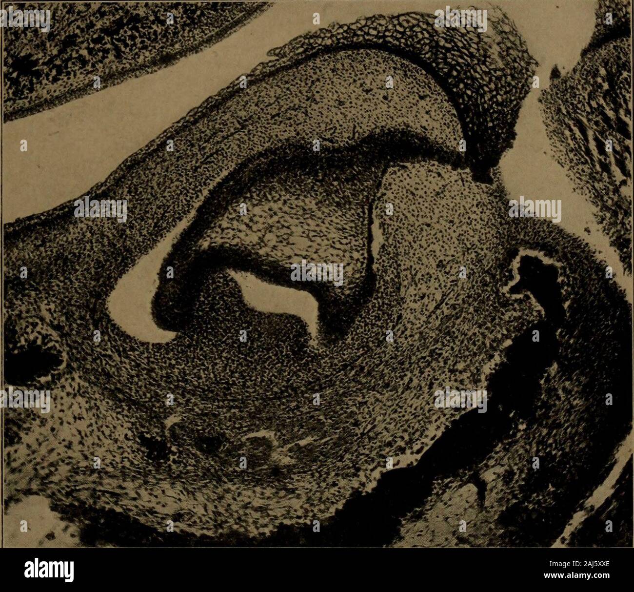 Germs of the permanent teeth hi-res stock photography and images - Alamy