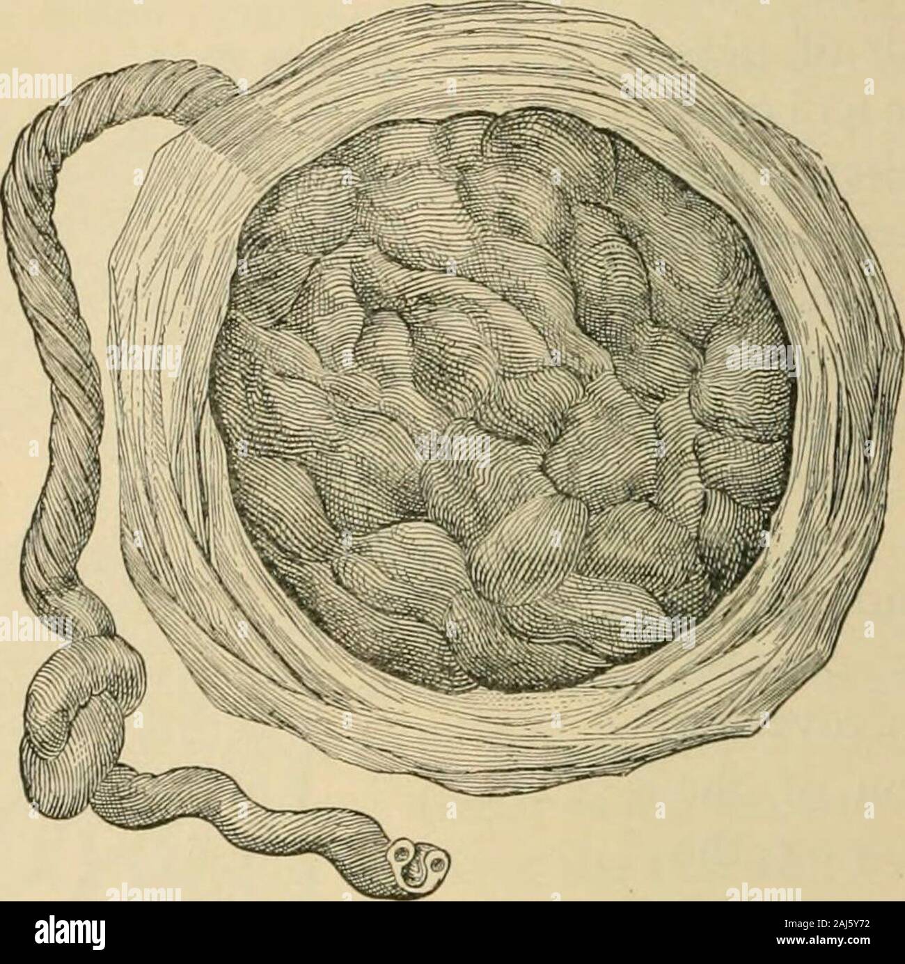 Placenta formation hi-res stock photography and images - Alamy