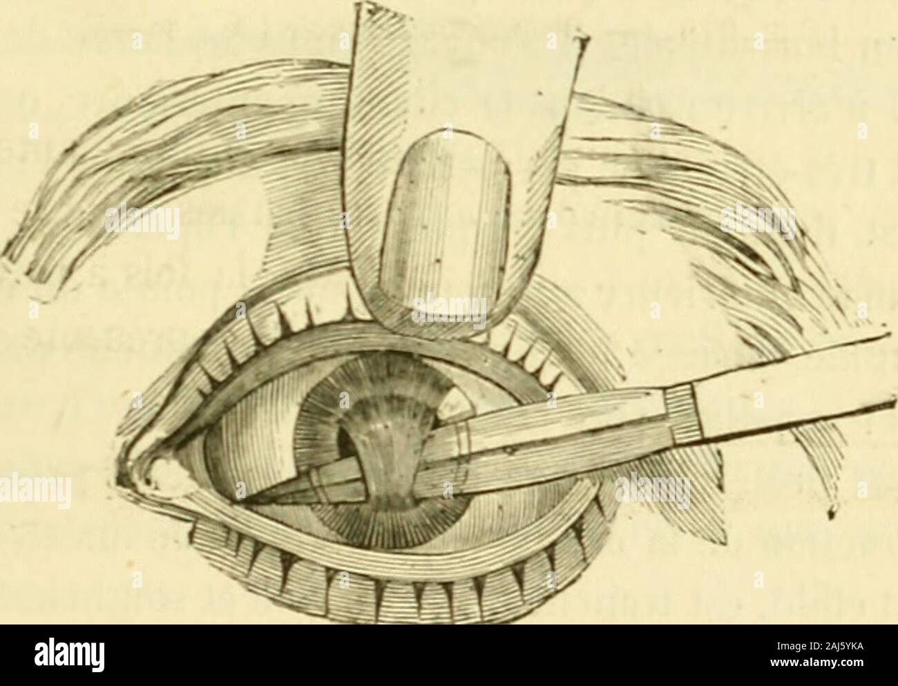 Obstruer hi-res stock photography and images - Alamy