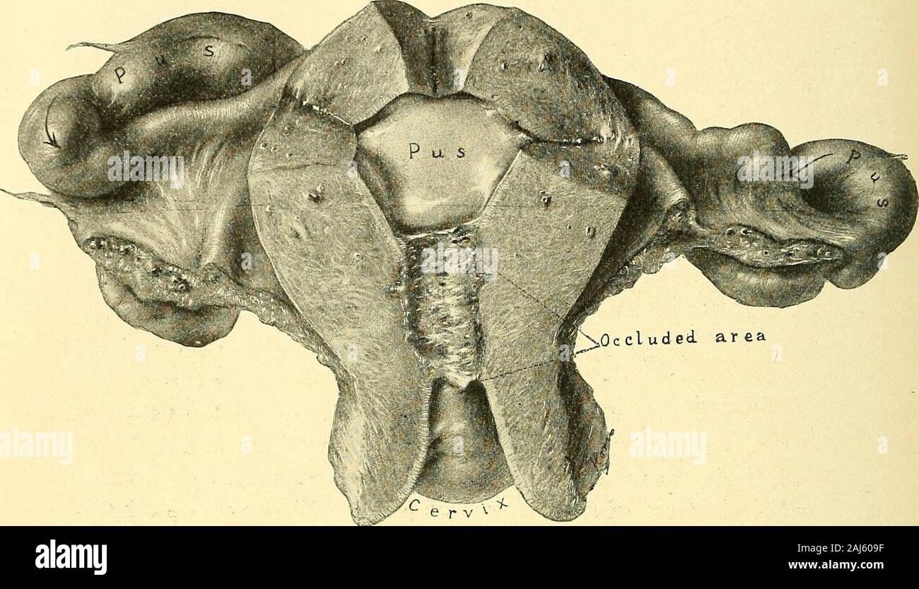 Pig uterus hi-res stock photography and images - Alamy