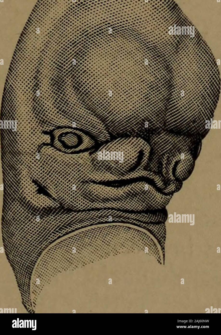 Embryo 3 weeks hi-res stock photography and images - Alamy