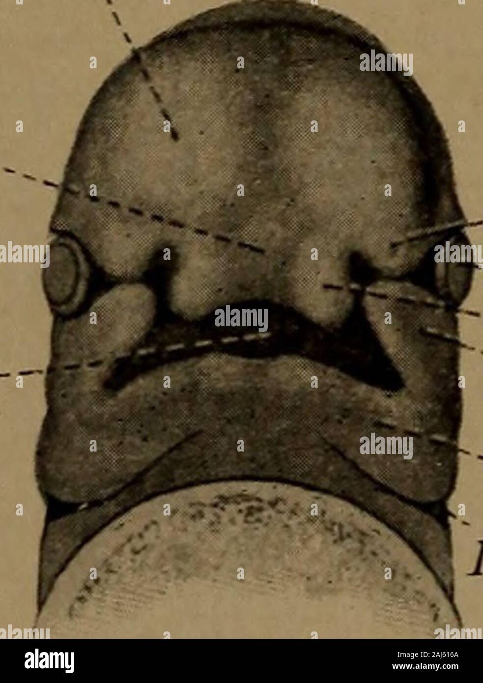 Mandibular lateral incisor hi-res stock photography and images - Alamy