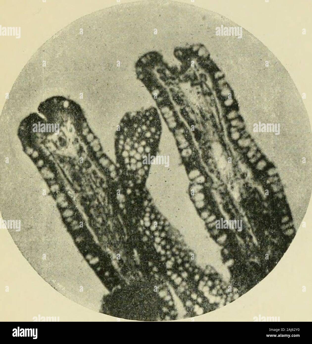 Some points in the anatomy, pathology, and surgery of intussusception ...