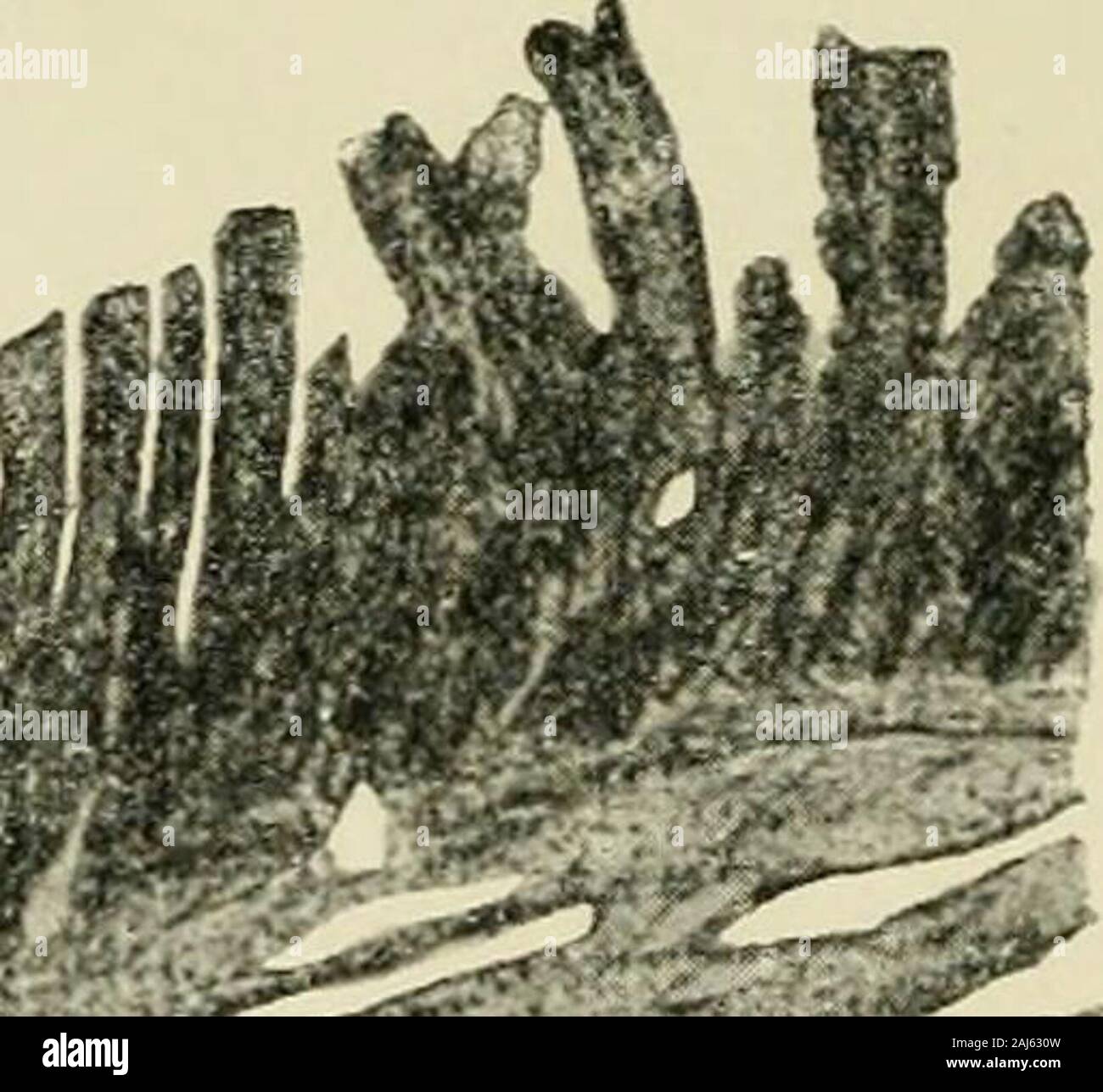Some points in the anatomy, pathology, and surgery of intussusception ...