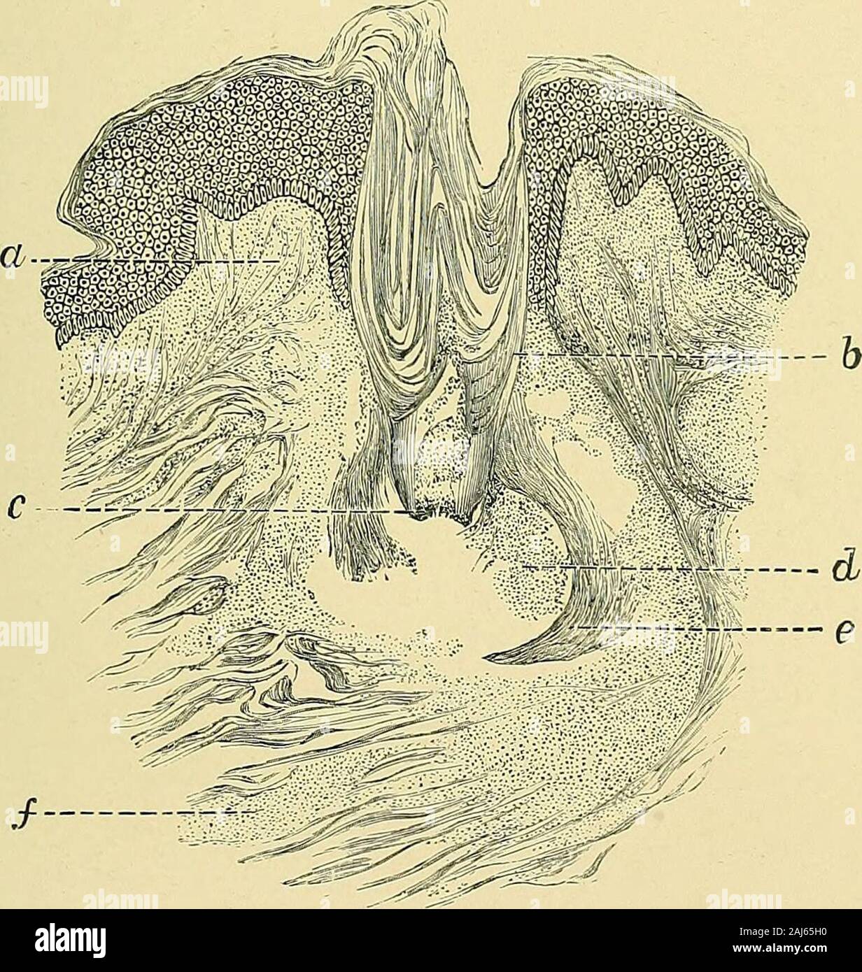 Vesicular eruptions hi-res stock photography and images - Alamy