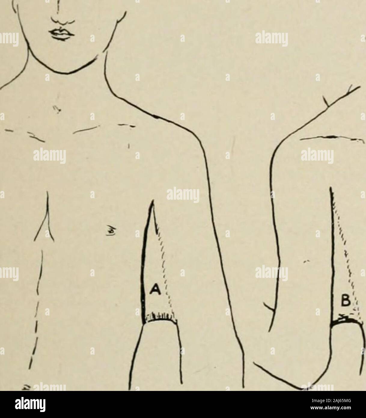 Darklines hi-res stock photography and images - Alamy