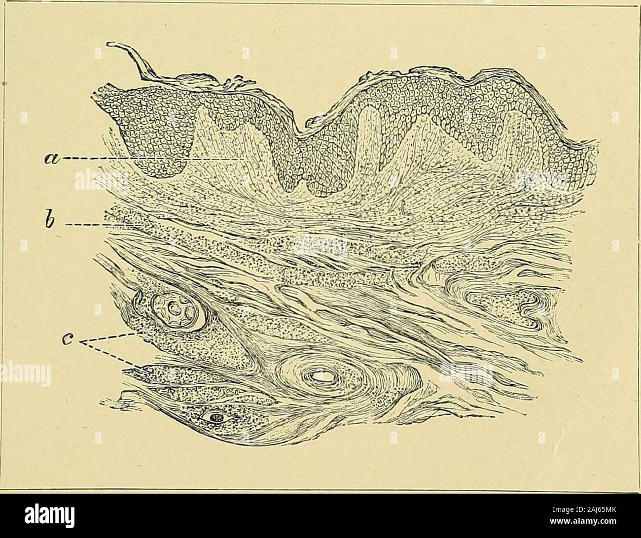 Syphilis . Fig. 2.. AFFECTIONS OF THE SKIN. 121 layer is lost, the ...
