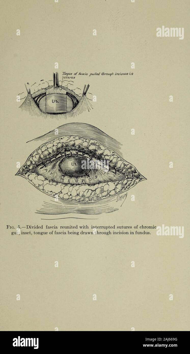 Transactions of the Southern Surgical and Gynecological Association ...