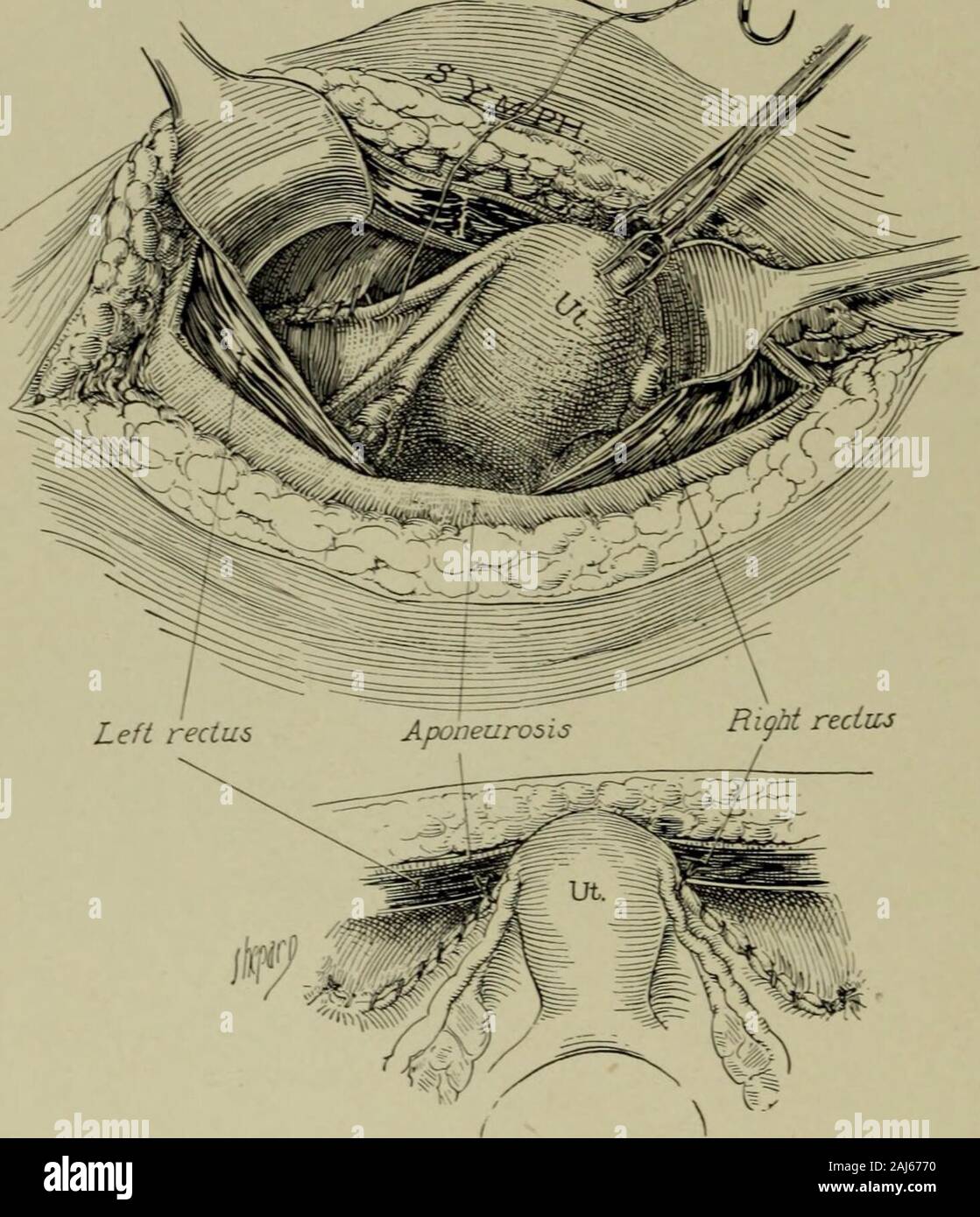 Transactions of the Southern Surgical and Gynecological Association ...
