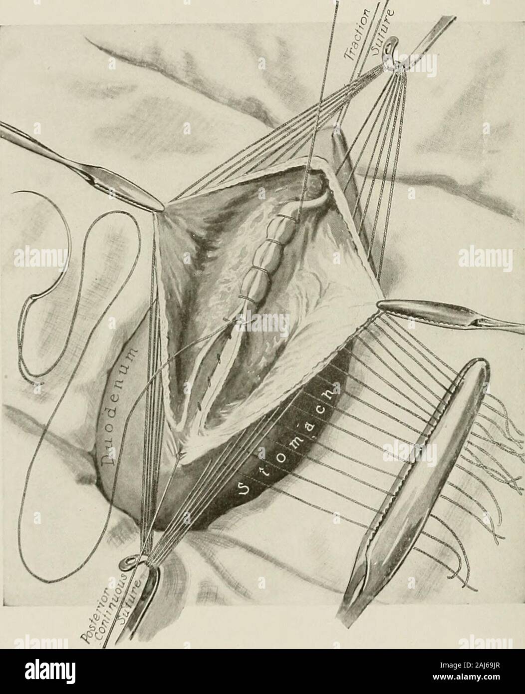 Surgical treatment; a practical treatise on the therapy of surgical ...