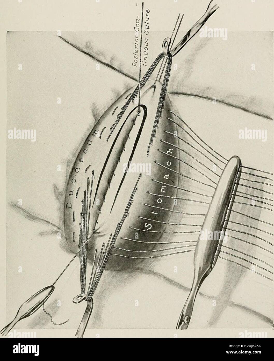 Surgical treatment; a practical treatise on the therapy of surgical ...