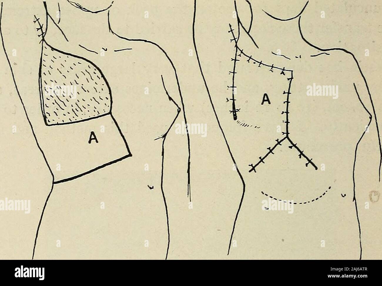 Plastic surgery ad hi-res stock photography and images - Alamy