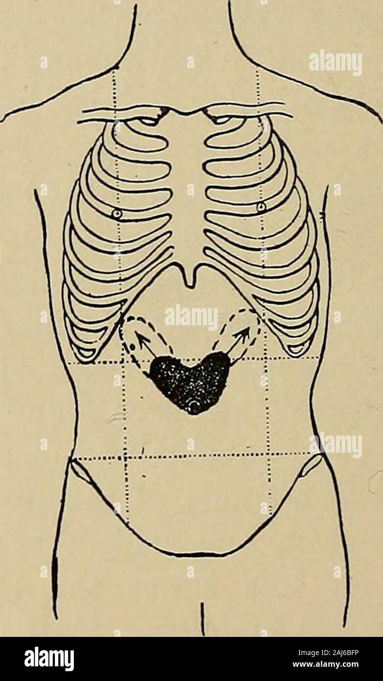 Hypochondrium hi-res stock photography and images - Alamy