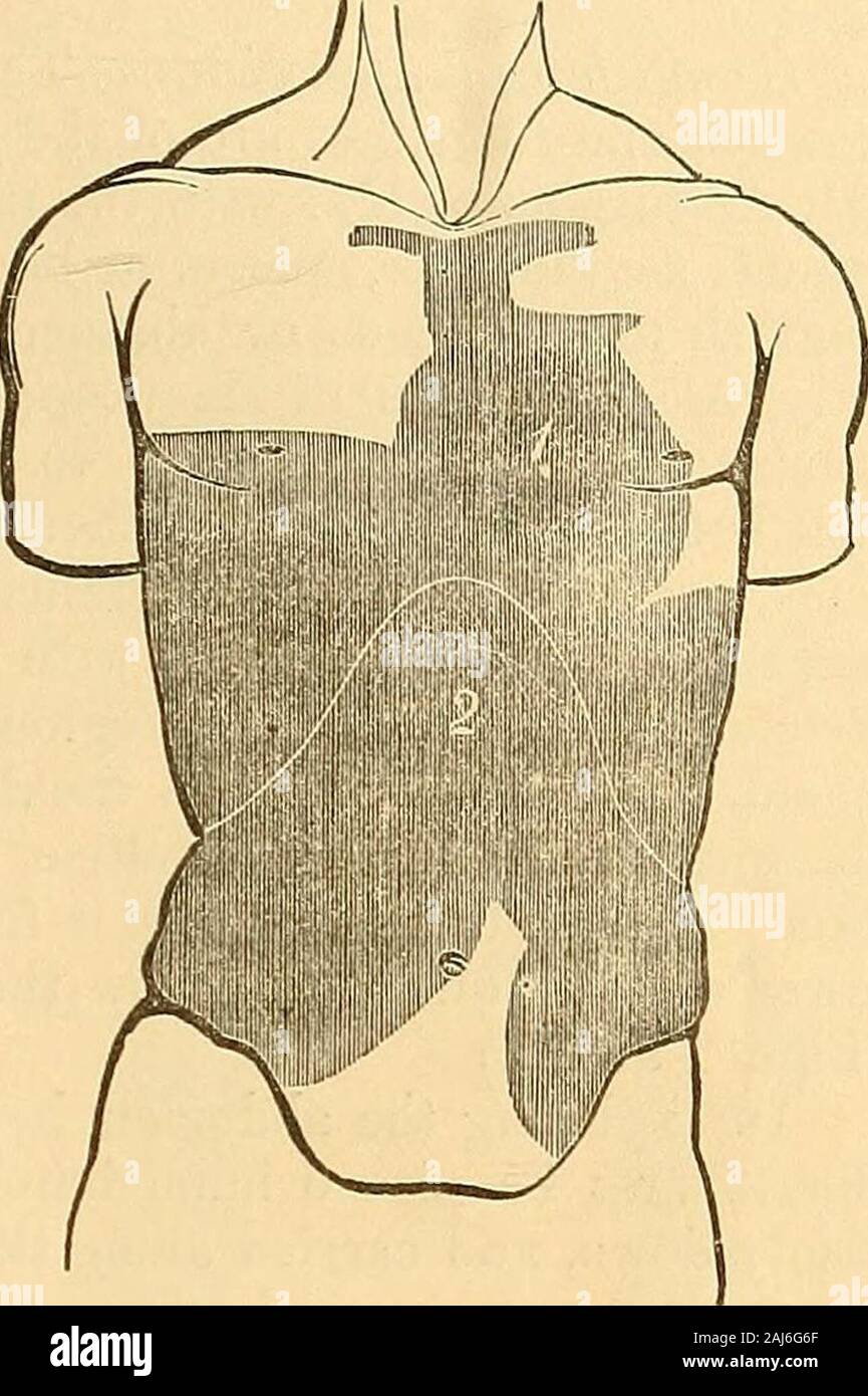 Clinical lectures on the principles and practice of medicine . the ...