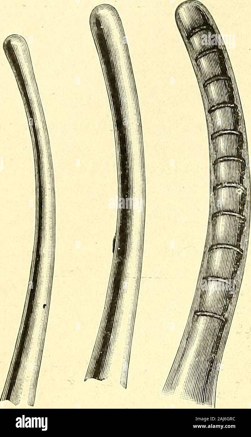 Operative gynecology : . t a symptomcommon to a number of diseased ...